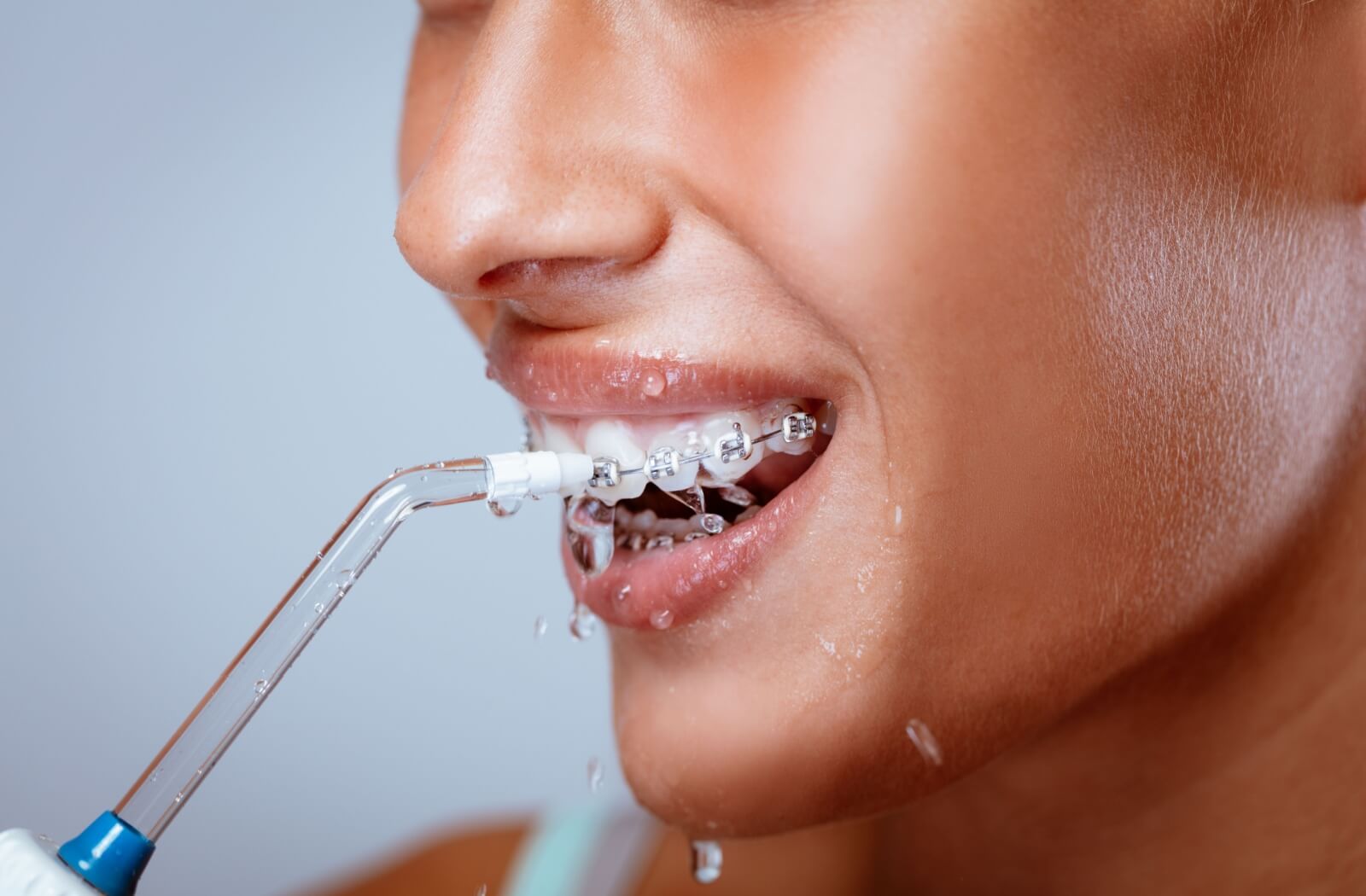How to Floss with Braces | Orthodontic Smile Studio | ON